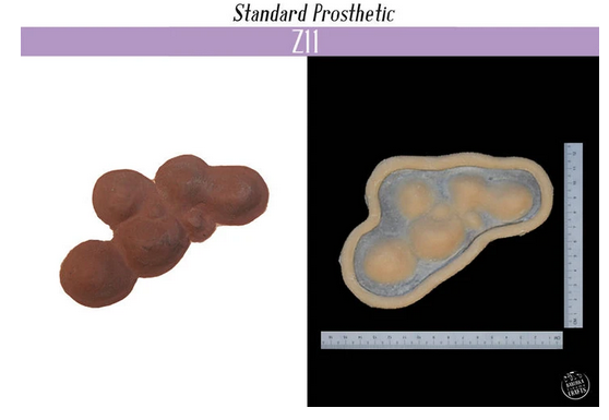 Infection - Z11 Silicone Prosthetic